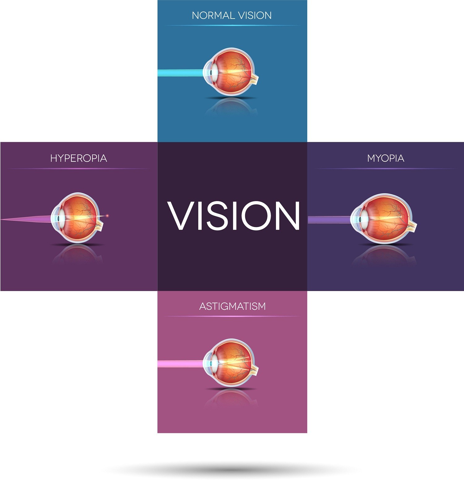 What Does LASIK Treat | Correct Vision Laser Institute | Improving ...